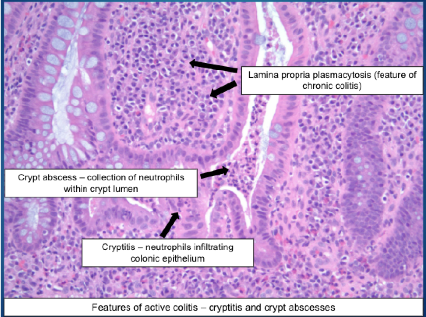 Case 1: Pathology Continued – GI SIM