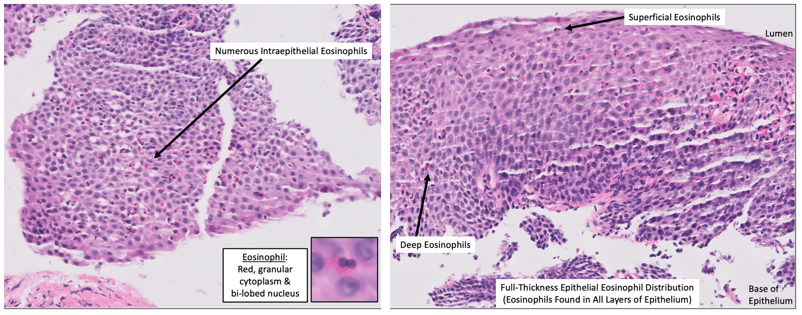 Case 8: Endoscopy – GI SIM