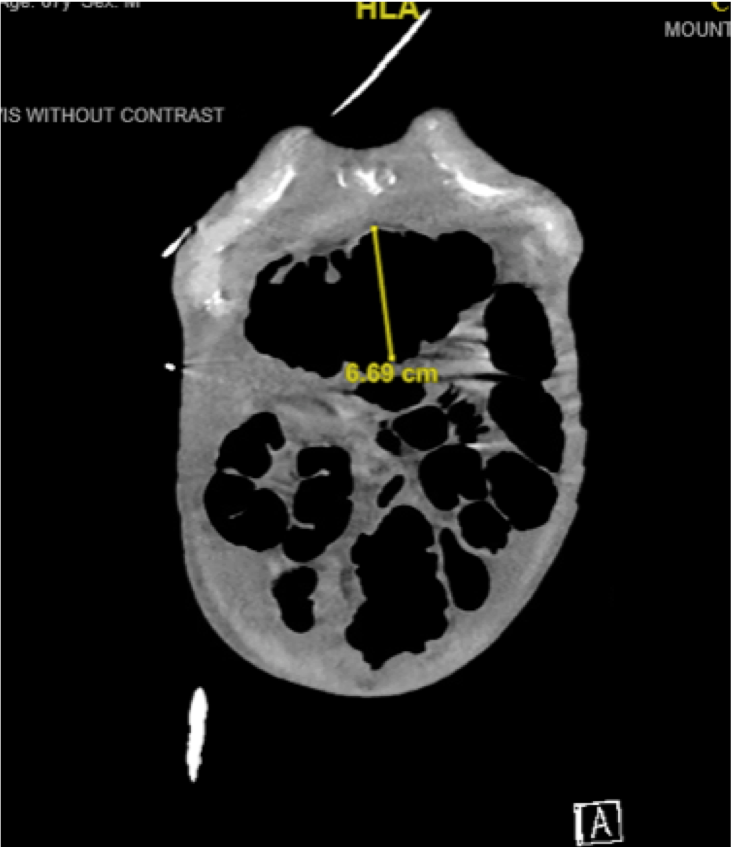 Case 10: Diagnostic Testing – GI SIM